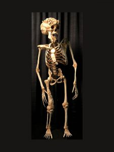 The Elephant Man, Full Skeleton
