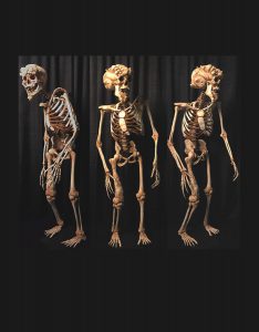 The Elephant Man, Full Skeleton