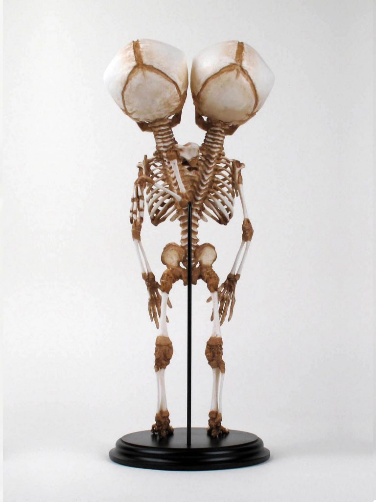 Two-Headed Baby Skeleton (Y-Baby Skeleton)